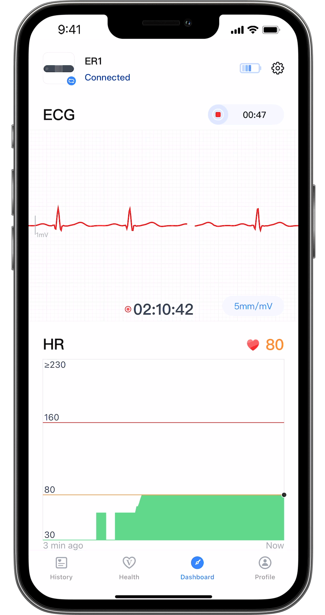 EKG monitor 24-72 órás holtrer EKG - ER1W-24 - Orvostechnik